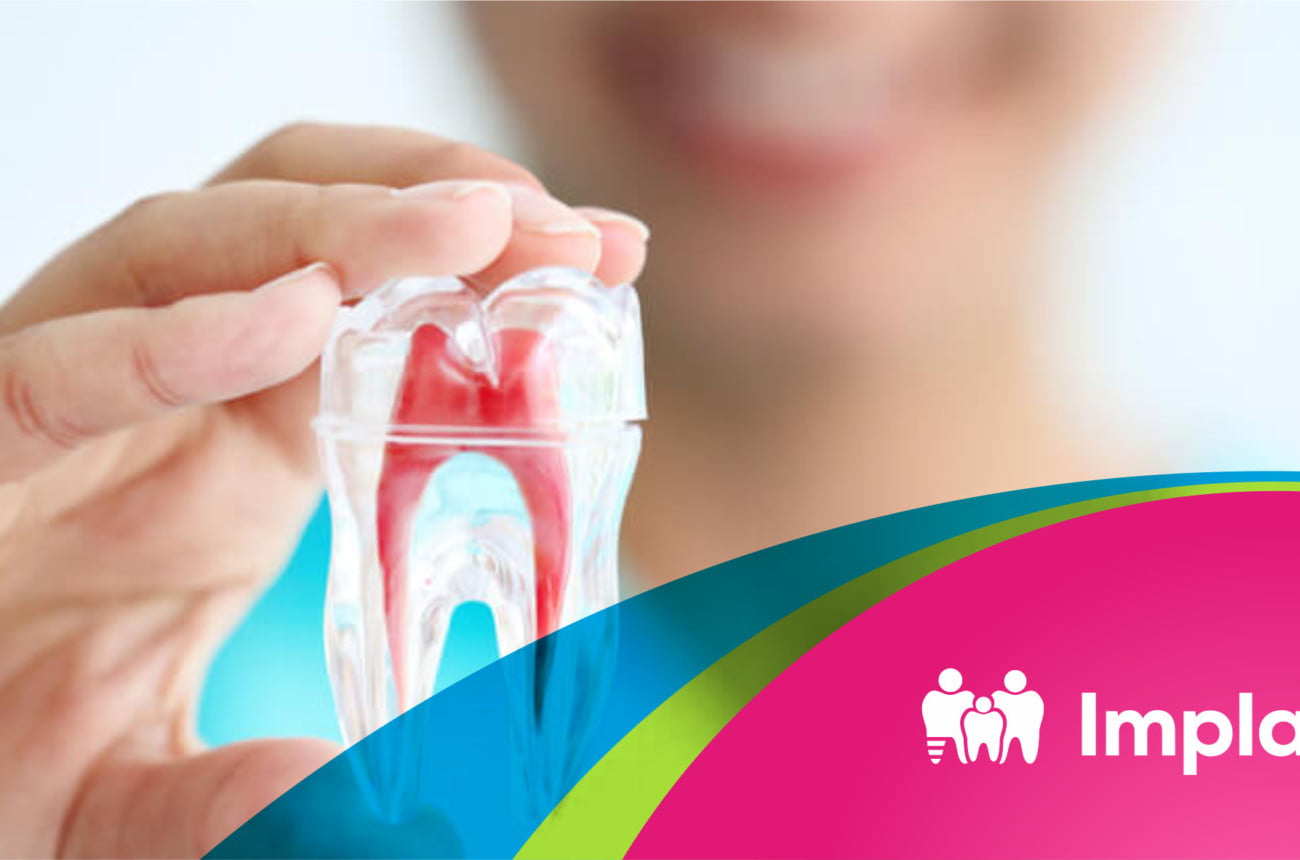 ¿Cuánto cuesta sacarse una muela? - Clínica Dental Implantsite