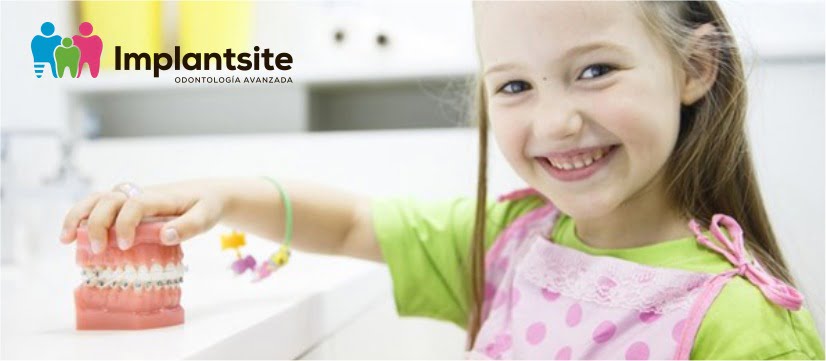 ¿Cuándo poner brackets a los niños? | Ortodoncia infantil en Sevilla